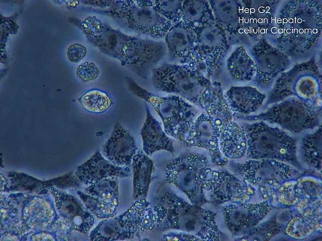 Hep G2 - Wikiwand