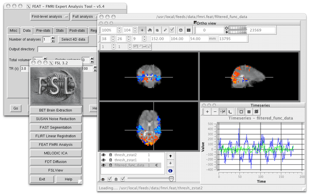 FMRIB Software Library - Wikiwand